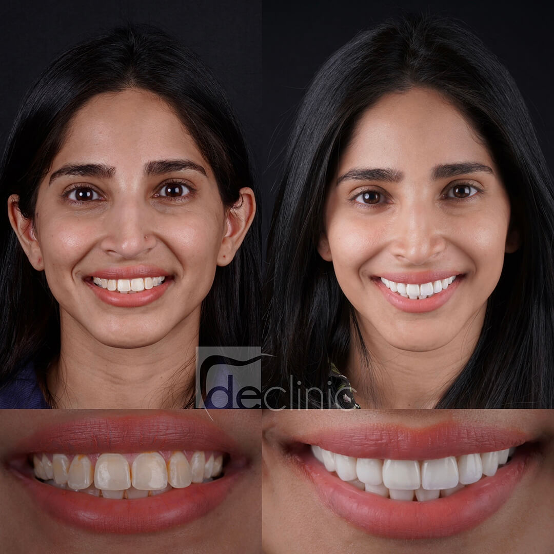 Digital Smile Design: The Key to a Great First Impression - Dental ...